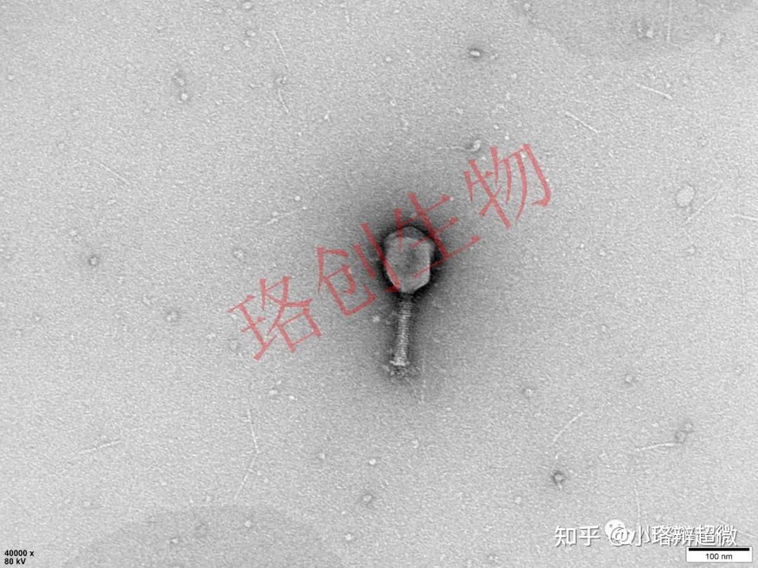 第十三期：透射电镜下的噬菌体 - 知乎