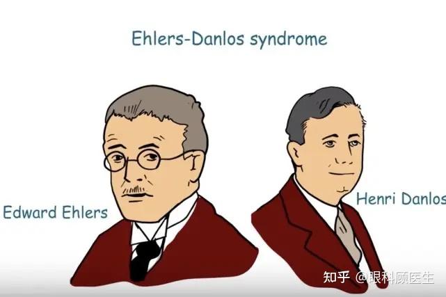 Ehlers-Danlos综合征是什么病？ - 知乎