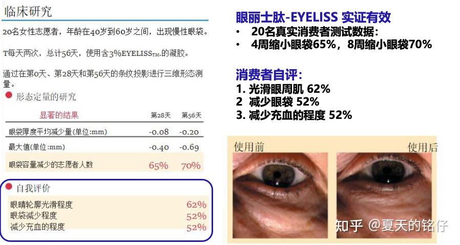 美国小众冷门德玛森氏维K眼霜，认真、靠谱、亲测科普文 - 知乎
