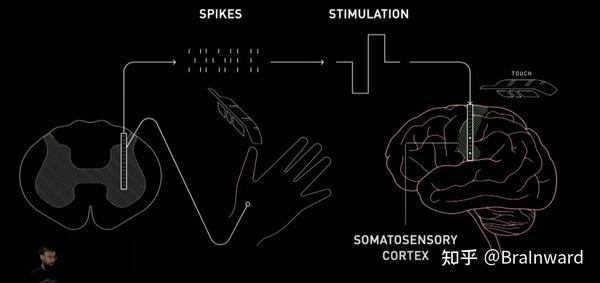 解密马斯克「Neuralink」2022最新进展，一文带你深入了解 - 知乎