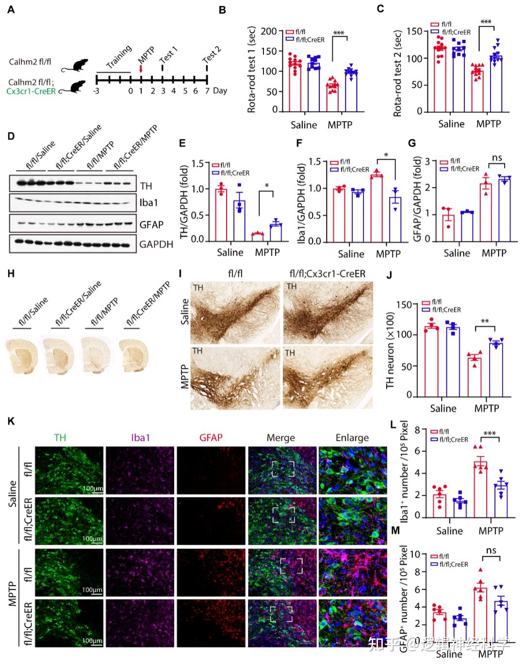 Sci Adv+Theranostics︱军事医学研究院袁增强/中央民族大学程金波团队揭示钙稳态调节蛋白Calhm2调控神经退行性疾病新机制 - 知乎