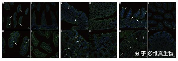 AAV感染肠道组织—血清型/启动子/注射方式/用量 - 知乎