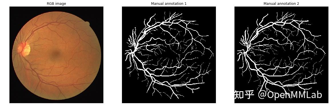 超详细！带你轻松掌握 MMSegmentation 整体构建流程 - 知乎