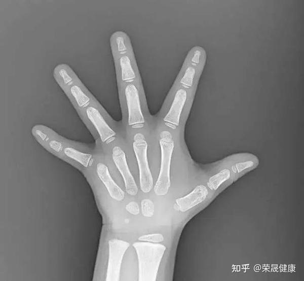 父母必读 | 刻在中国人DNA里的身高执念 - 知乎