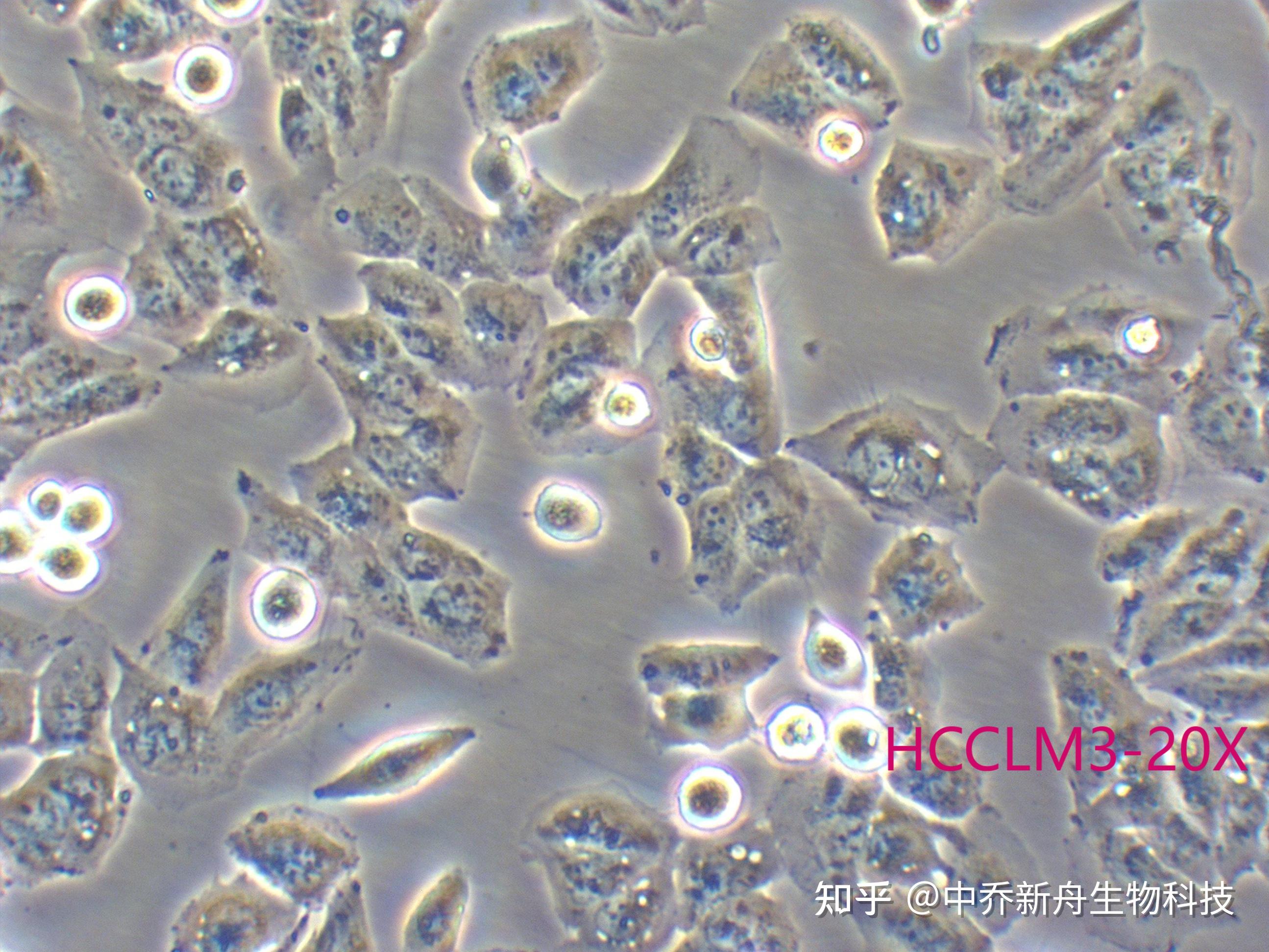 HCCLM3细胞培养实验操作方法和复苏 - 知乎