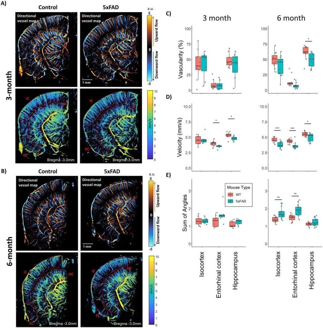 J Neurosci:超分辨率超声 “透视” 阿尔茨海默小鼠脑内血管 - 知乎