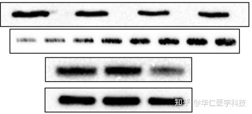 从青铜到王者，科研小白的进阶之路（1）——Western Blot实验教程 - 知乎