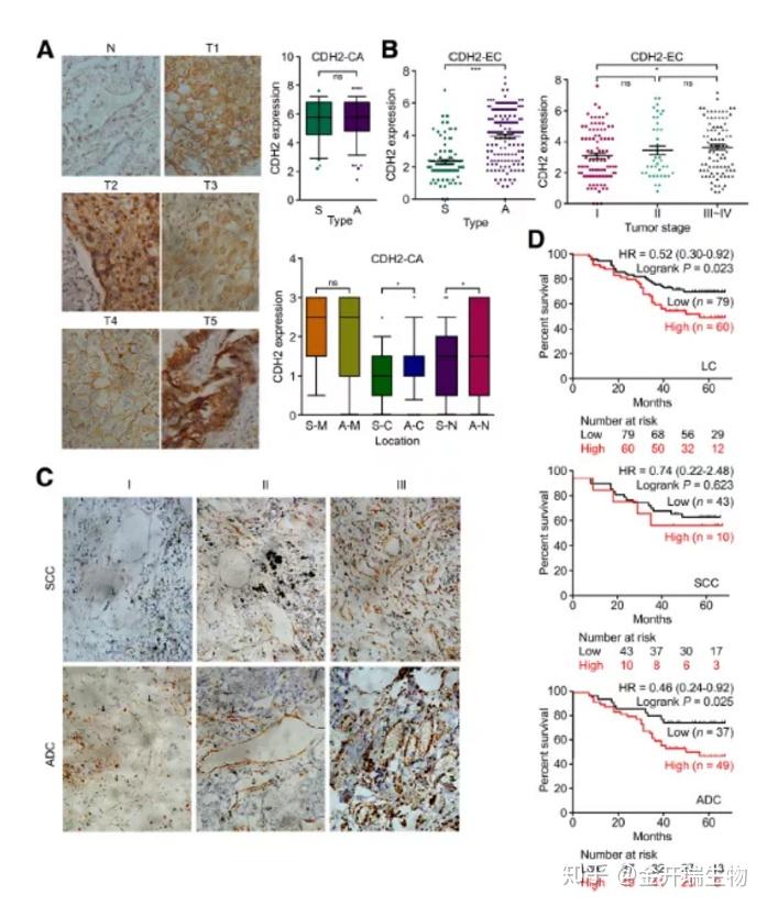 蛋白质组学联合多种分子检测技术揭示CDH2以促进血管生成的方式促进肺腺癌的发生发展 - 知乎