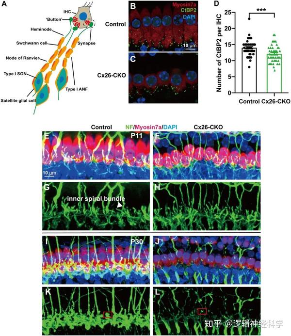 Neurosci Bull︱华中科技大学孙宇团队建立新的Cx26条件敲除小鼠模型，揭示Gjb2敲除小鼠外周听觉系统的病理生理改变 - 知乎
