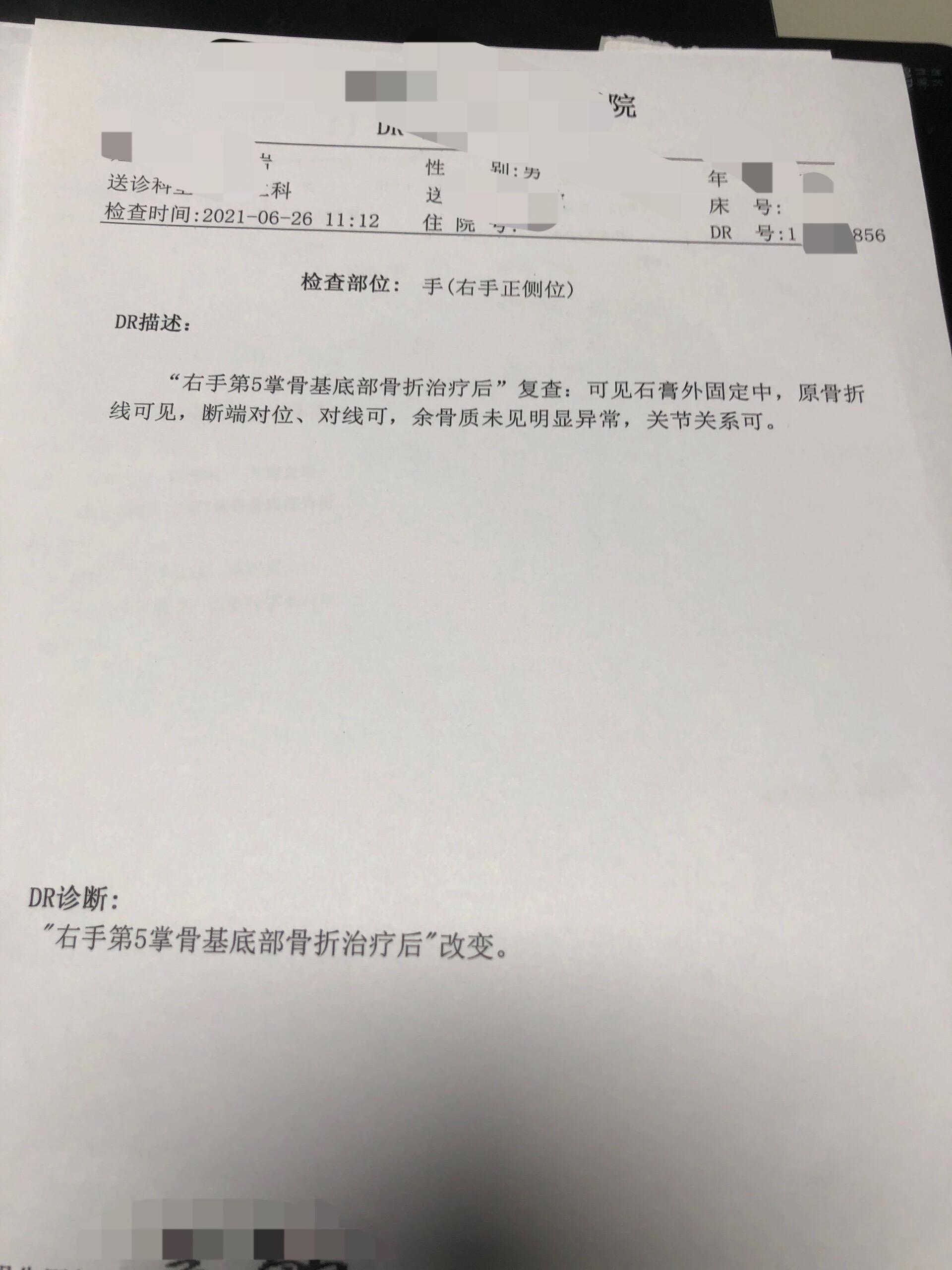 骨折记——掌骨骨折 知乎