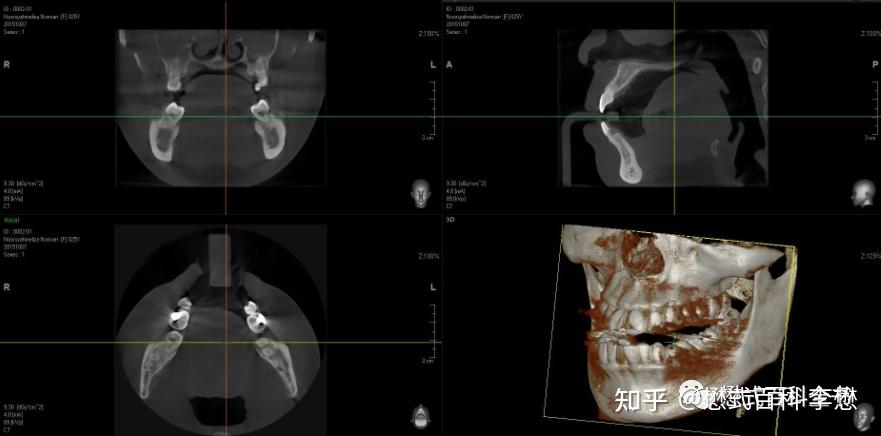 什么是CBCT？它和CT有什么区别？ - 知乎