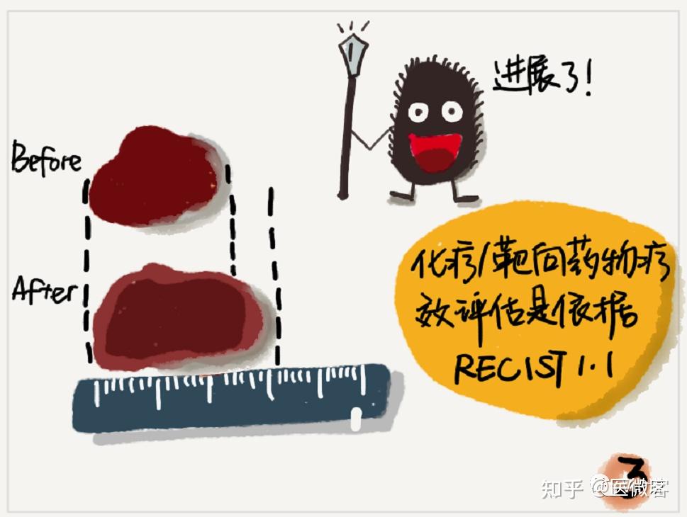 浅谈肿瘤疗效评价的新标准---irRC、iRECIST、ImRECIST - 知乎