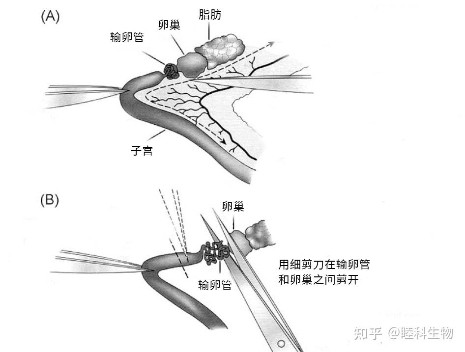 小鼠卵巢摘除模型OVX（骨质疏松）构建细节 - 知乎