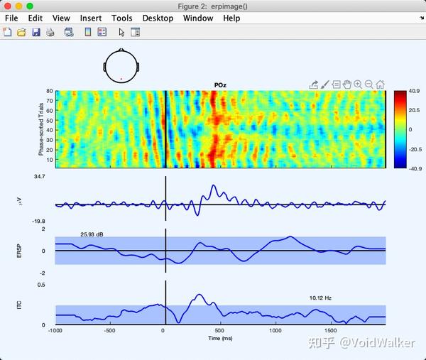 EEGLAB学习笔记--Plot data--ERP - 知乎