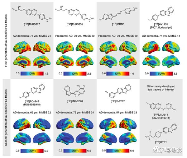 Tau PET成像在神经退行性Tau病中的应用—仍然是一个挑战 - 知乎