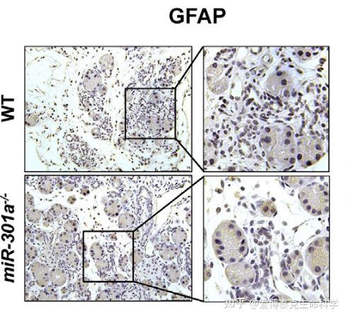 转化医学明星靶点-星型胶质细胞标志物GFAP - 知乎