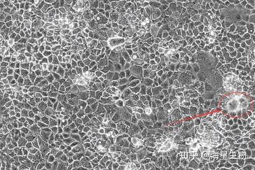 人结直肠腺癌细胞(Caco-2)培养要点 - 知乎