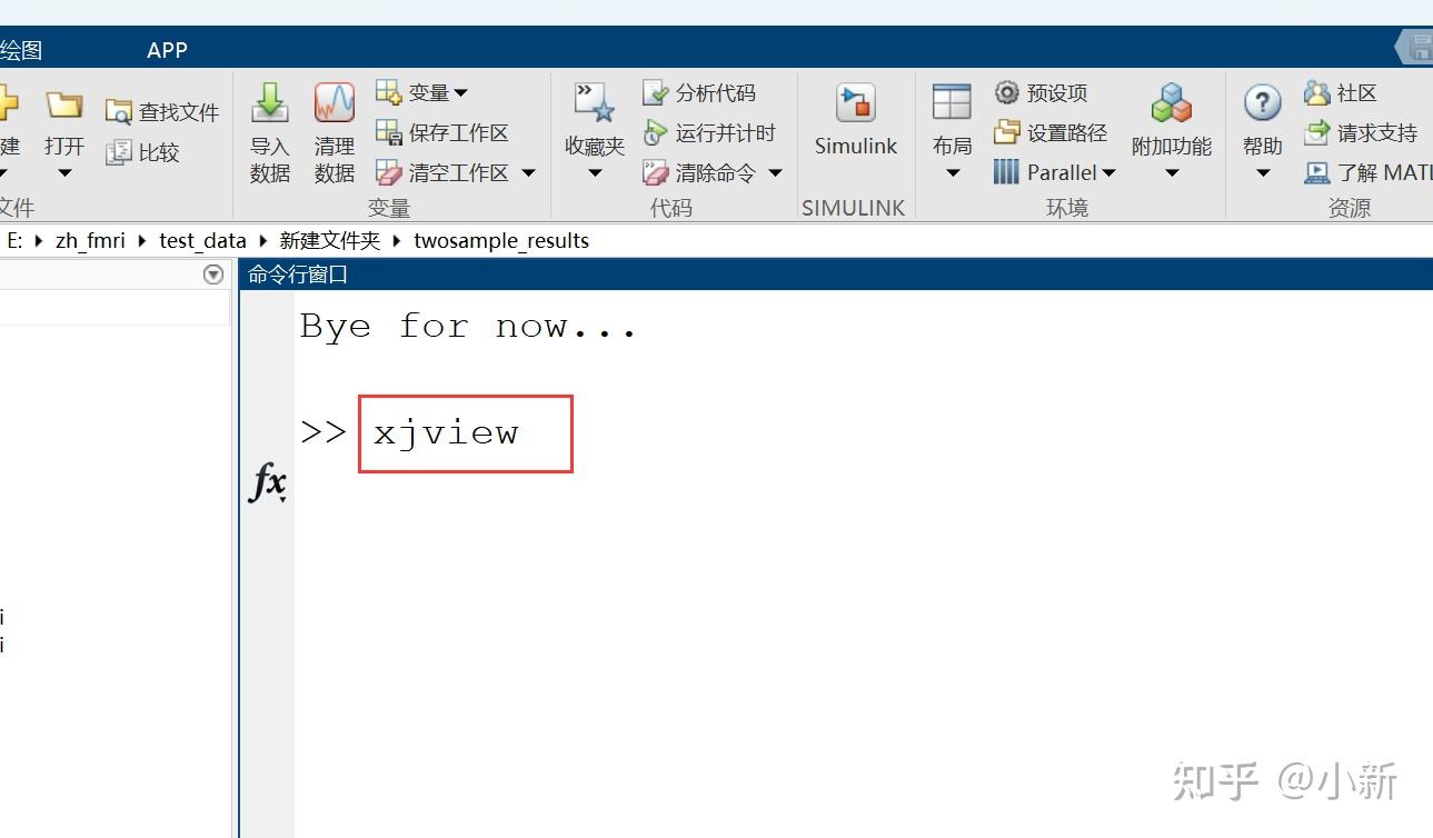 15（1）-SPM-fmri任务态 结果查看与汇报 xjview - 知乎