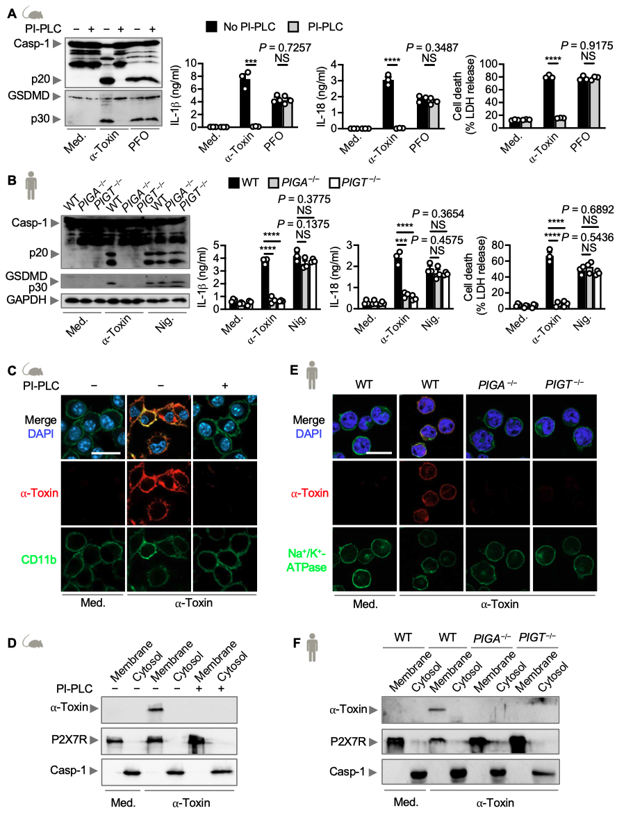 Science子刊丨败毒梭菌α-毒素通过与 GPI 锚定蛋白结合来激活 NLRP3炎症小体 - 知乎