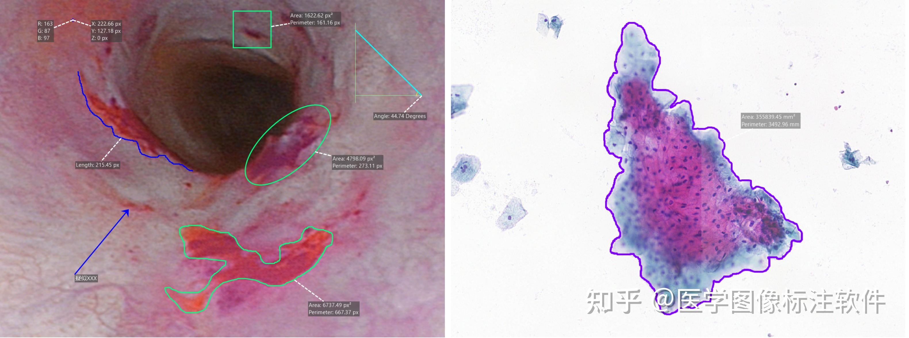 助力医学临床AI — MISAT医学图像分割与标注软件套装 - 知乎