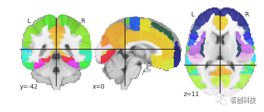 fMRI连接性分析 - 知乎