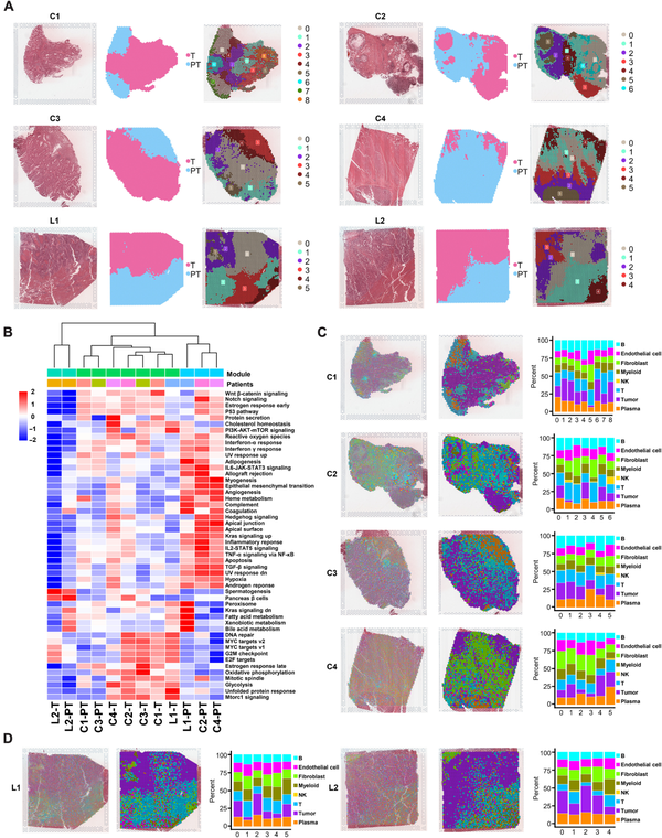 文献解读｜单细胞和空间转录组揭示结直肠癌肝转移的细胞异质性 - 知乎