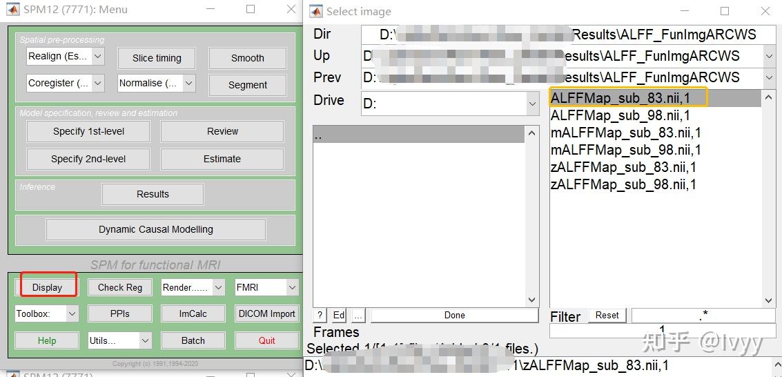 DPABI数据处理 - 知乎
