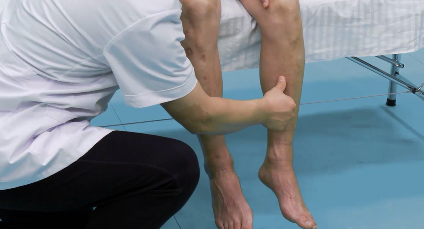 执业医师考试：体格检查-杂项02：四肢运动检查 - 知乎