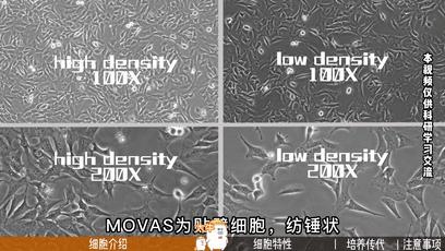 MOVAS细胞培养，小鼠主动脉平滑肌细胞培养攻略-丰晖生物 - 知乎