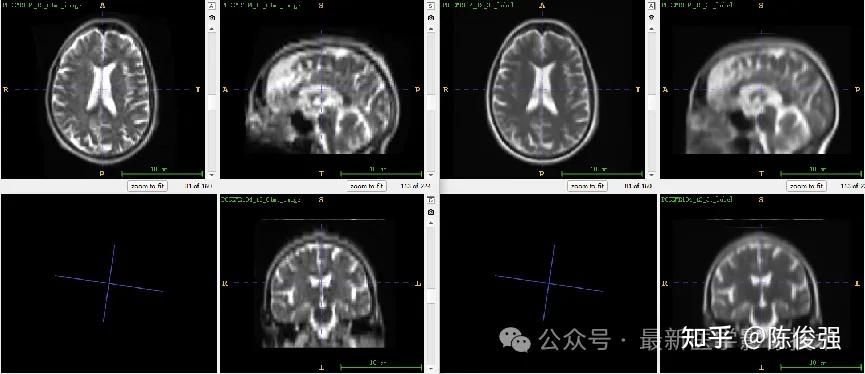 ULF-EnC2025——配对超低场 MRI 增强生成到高场 MRI - 知乎