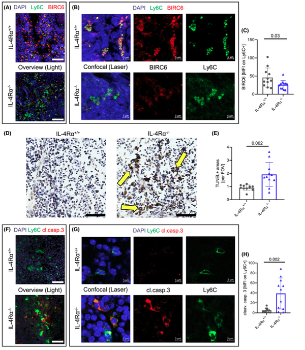 FASEB丨探索IL-4α在单核细胞中的作用 - 知乎