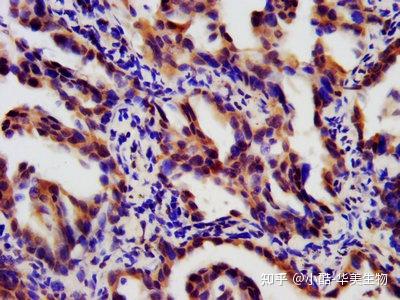 淋巴毒素β受体（LTBR）研究全景：结构、功能、疾病关联与药物研发新进展 - 知乎