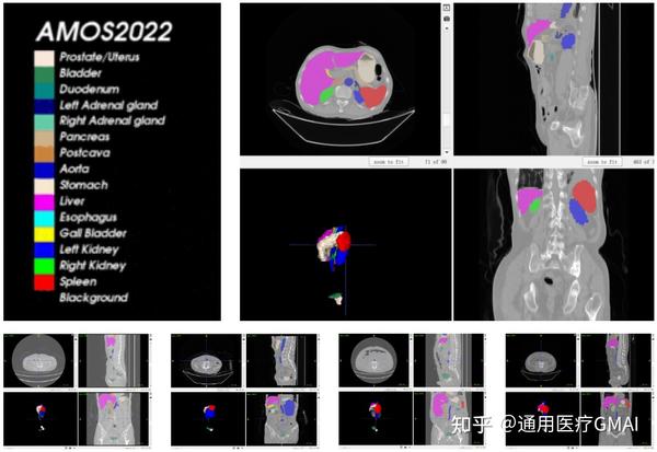 AMOS 2022 数据集介绍 - 知乎