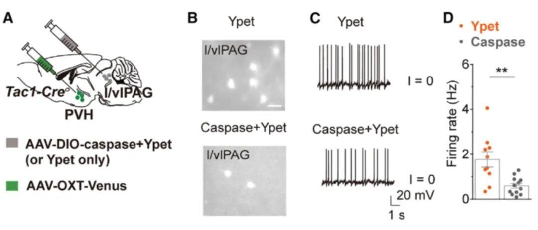 【独家合作】BrainVTA联合北大于翔课题组开发Cre依赖的可标记完整神经元形态的AAV病毒 - 知乎