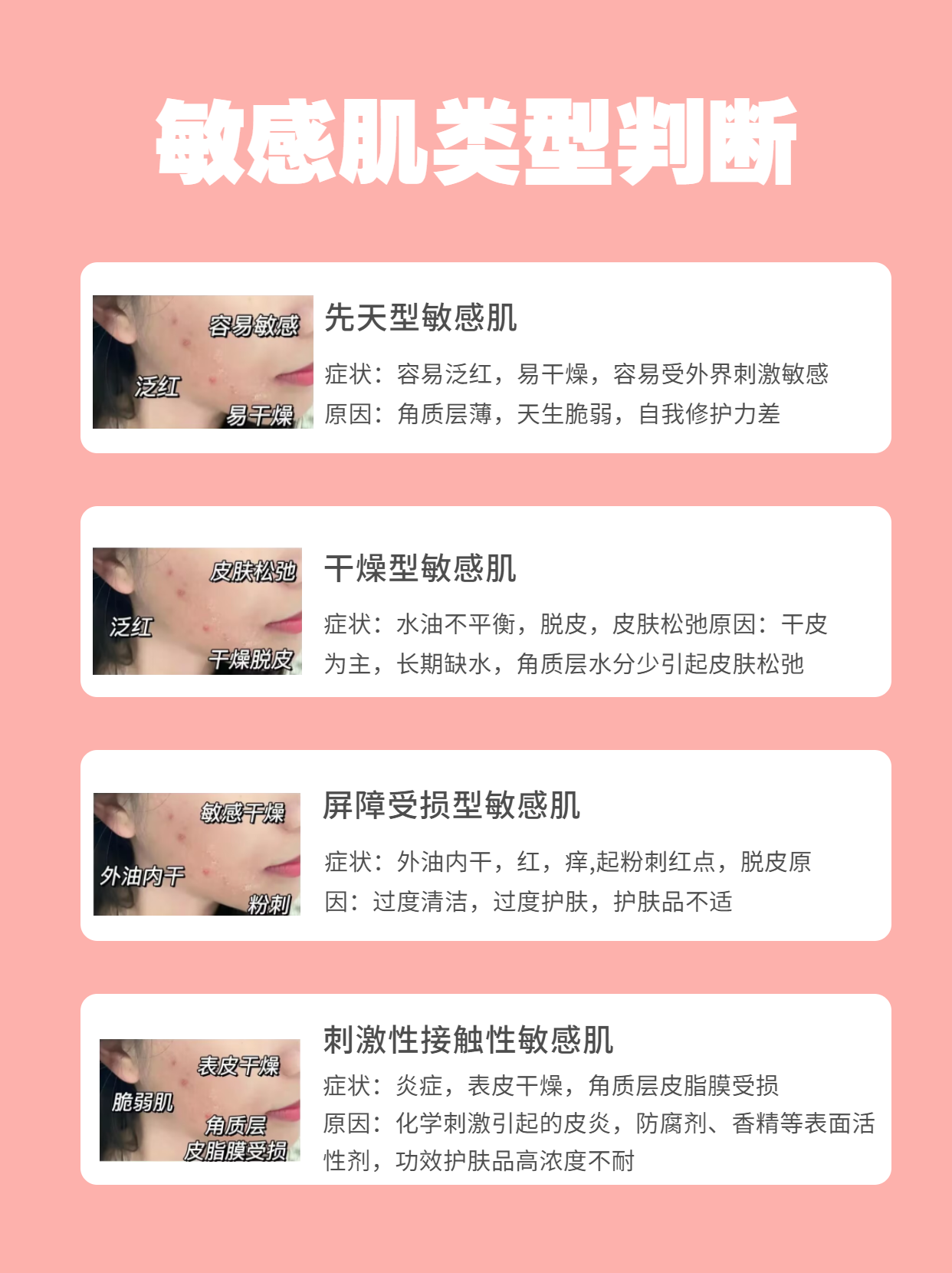 蒙迪莎白：敏感肌的四种类型and护肤攻略 知乎