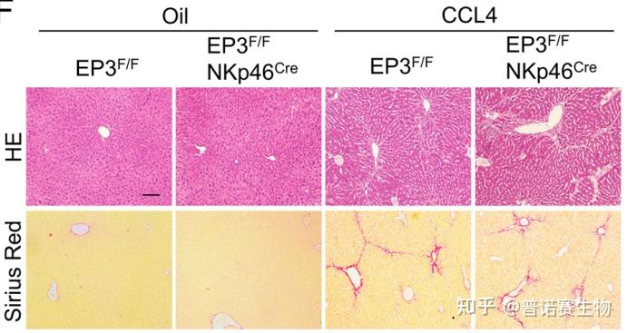文献解读 | J Exp Med发现NK细胞抑制肝纤维化的作用及机制 - 知乎