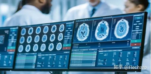 IRC独立影像评估之“8问” - 知乎