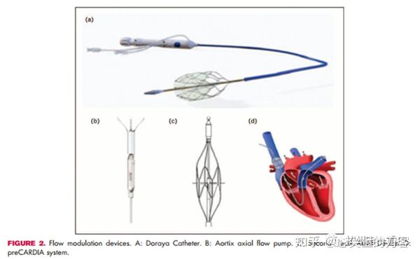 治疗心力衰竭的新装置 - 知乎