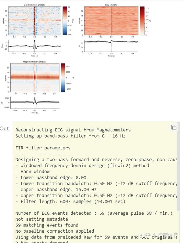 preprocessing——artifact detection - 知乎
