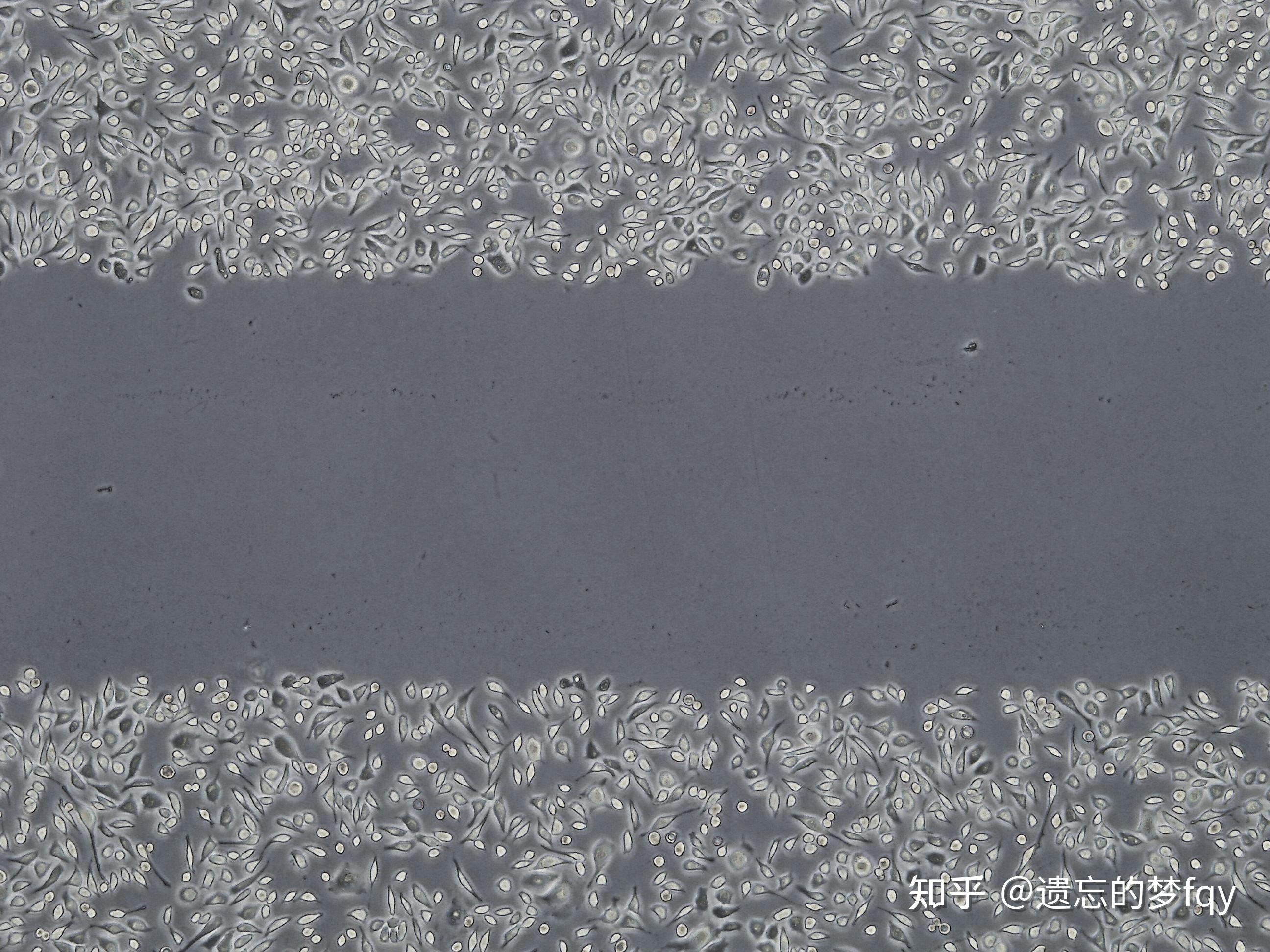 细胞形态之L929 - 知乎
