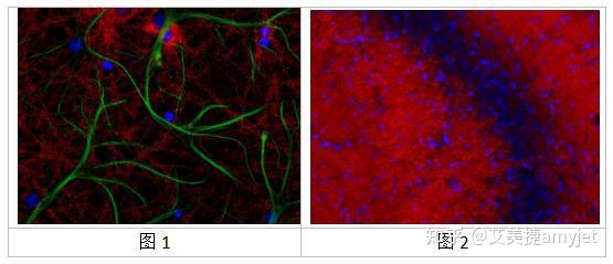 PSD95抗体研究丨SYSY PSD95抗体结果图展示 - 知乎