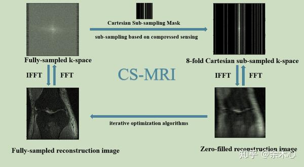 NAS for Compressed Sensing MRI Reconstruction - 知乎