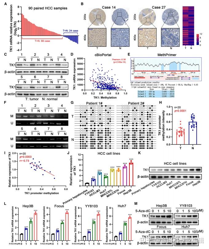 IF：29！国自然热点代谢重编程再发高分！南京医科大学王学浩/武汉大学张鹏团队揭示TK1在肝细胞癌中重要作用 - 知乎