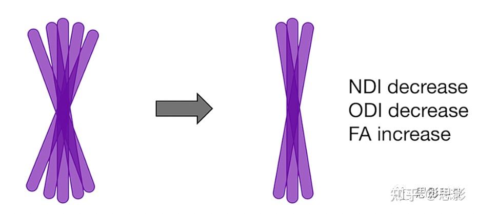NODDI在临床研究中的应用 - 知乎