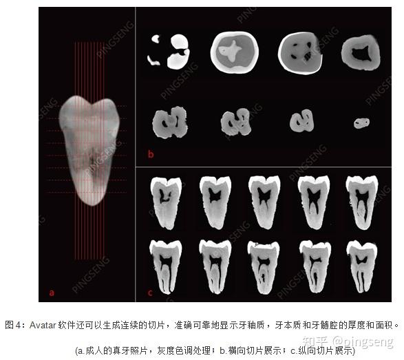 Micro CT在齿科研究中的应用 - 知乎