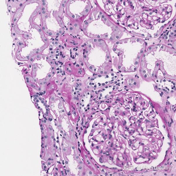 OpenMMLab打卡笔记（7）--MMSegmentation代码教学 - 知乎