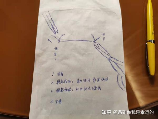 术后如何自己在家拆线 知乎