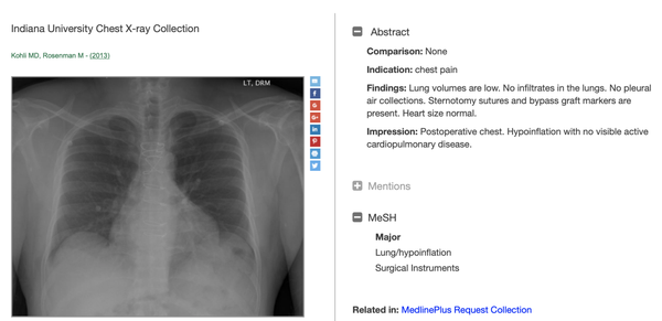 [论文笔记]On the Automatic Generation of Medical Imaging Reports - 知乎