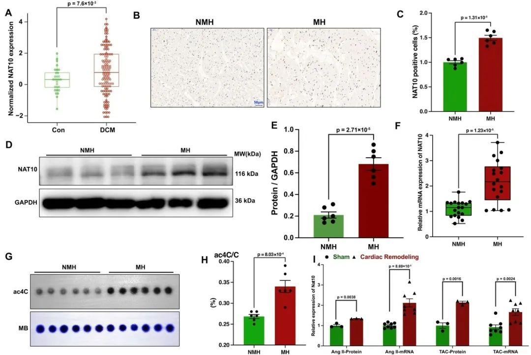 客户文章| Circ Res：南京医科大学孔祥清团队揭示NAT10介导ac4C乙酰化修饰在心脏重构中的新机制 - 知乎
