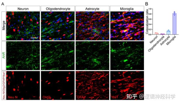 J Neuroinflammation｜复旦大学汪军/王彦青团队揭示小胶质细胞AhR受体调控吞噬作用改善脱髓鞘损伤中的机制 - 知乎